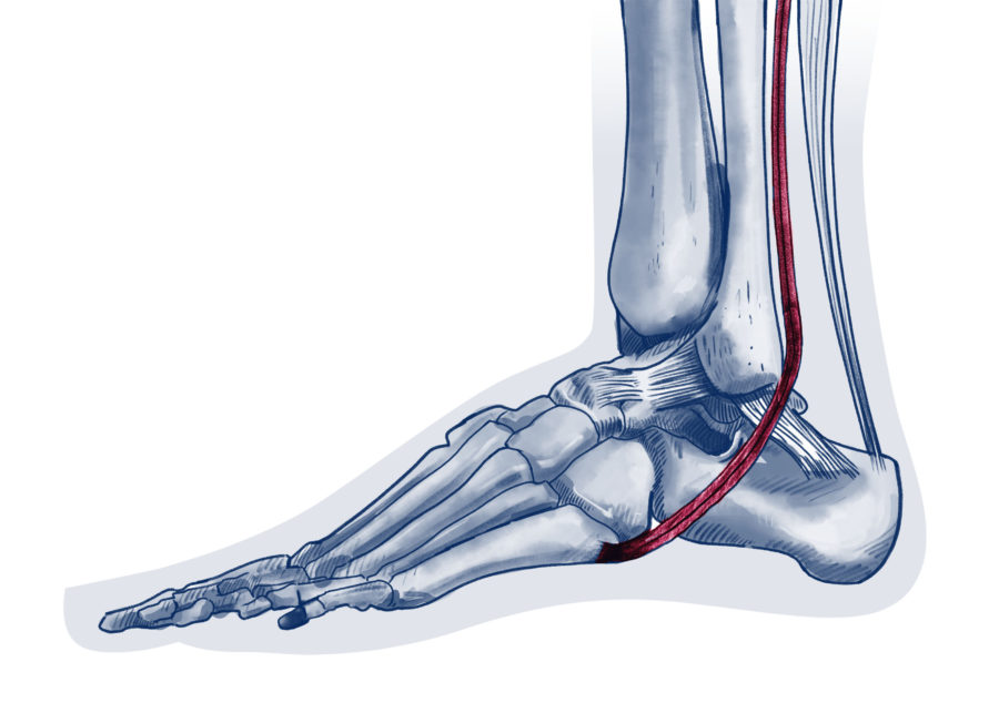 Pathologies Cheville - ISCO - Institut Spécialisé de Chirurgie ...